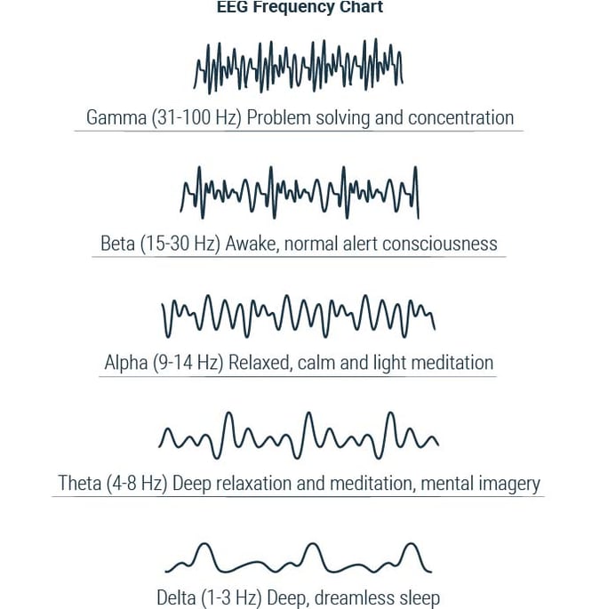 Understanding Electroencephalogram (EEG) for Better Brain Health