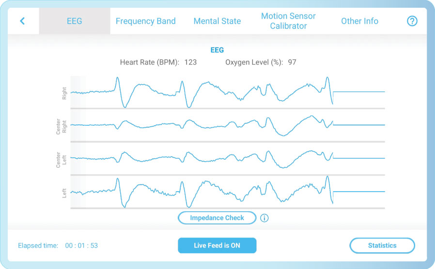 Get An Insight Into Your Brain | MindViewer